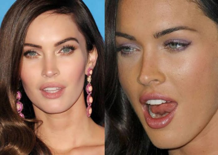 Is Megan Fox Secret in Cosmetic Surgery? - Verge Campus