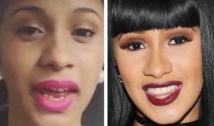 Cardi B Plastic Surgery or Age Transformation - Verge Campus