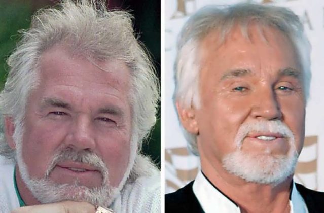 Kenny Rogers Transformation After Plastic Surgery - Verge Campus