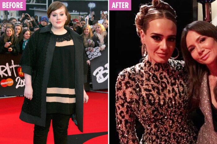 Doctors Claim Adele's Face Changed Due to Plastic Surgery Not Weight ...
