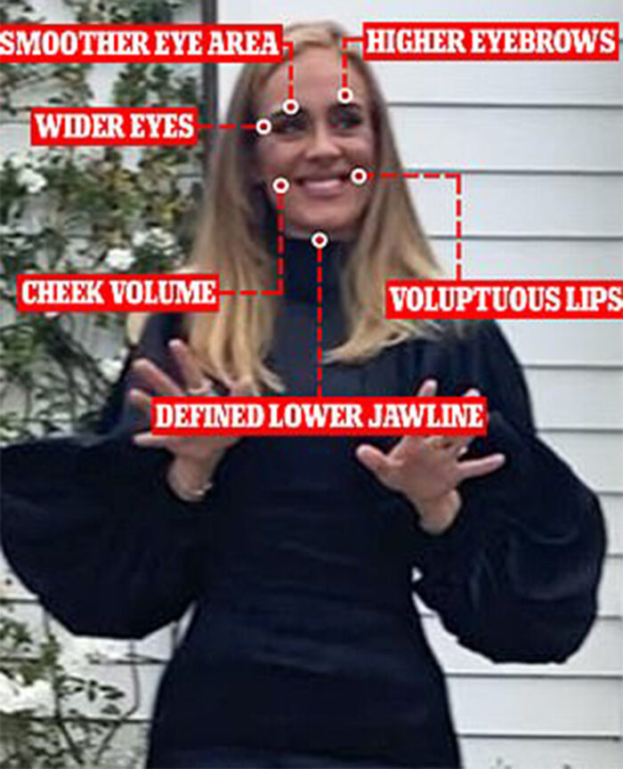 Doctors Claim Adele's Face Changed Due to Plastic Surgery Not Weight ...